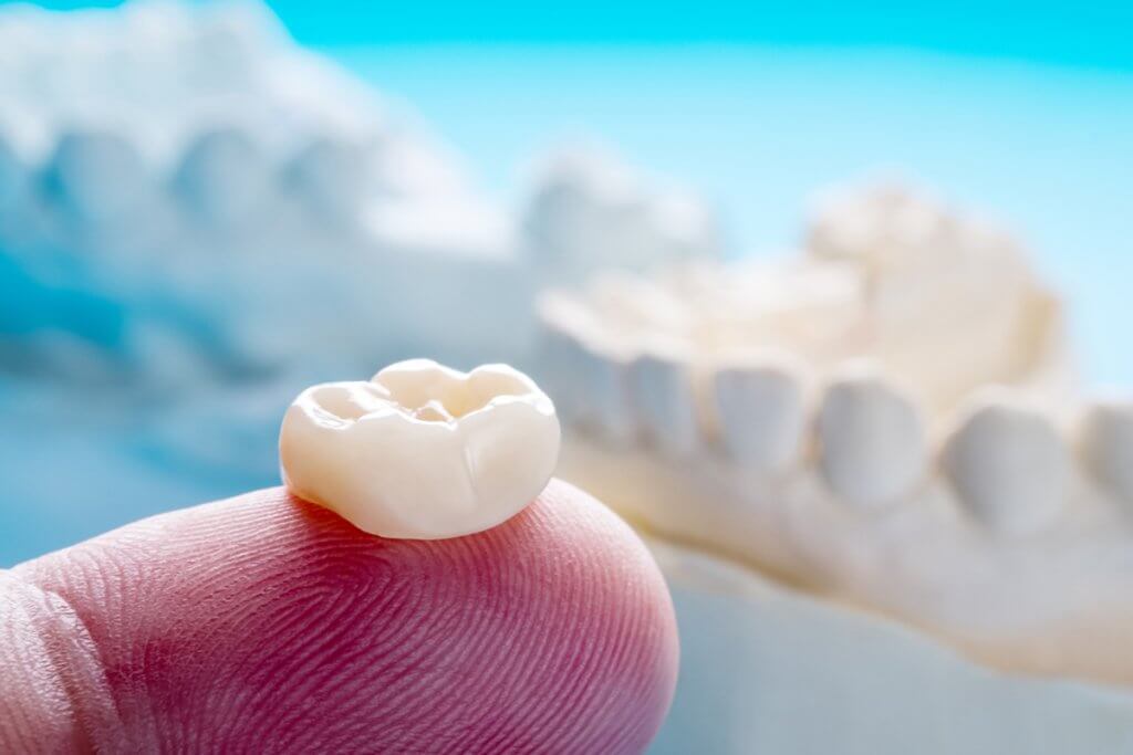 Temporary vs. Permanent Dental Crowns in Carmel, NY - Carmel Dental ...